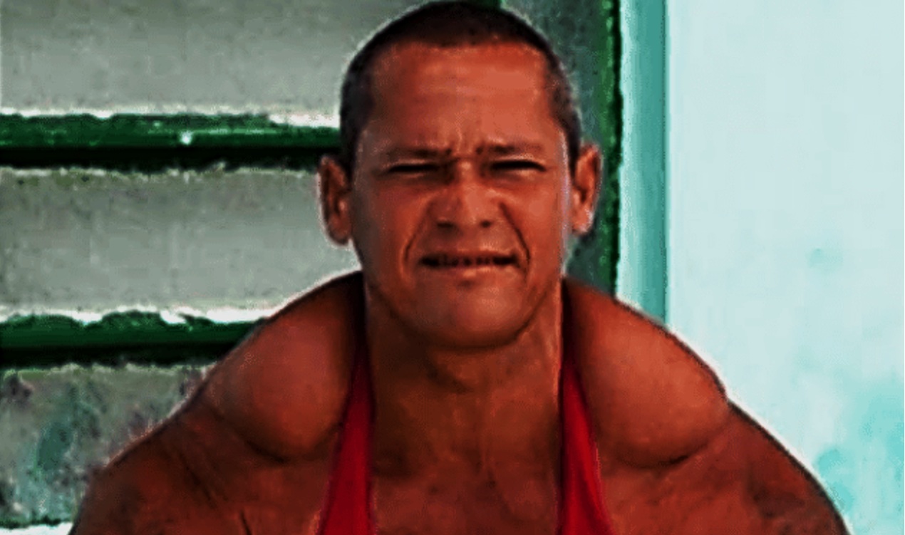 Adiós a ‘Popeye’: murió el fisicoculturista brasileño famoso por sus ...